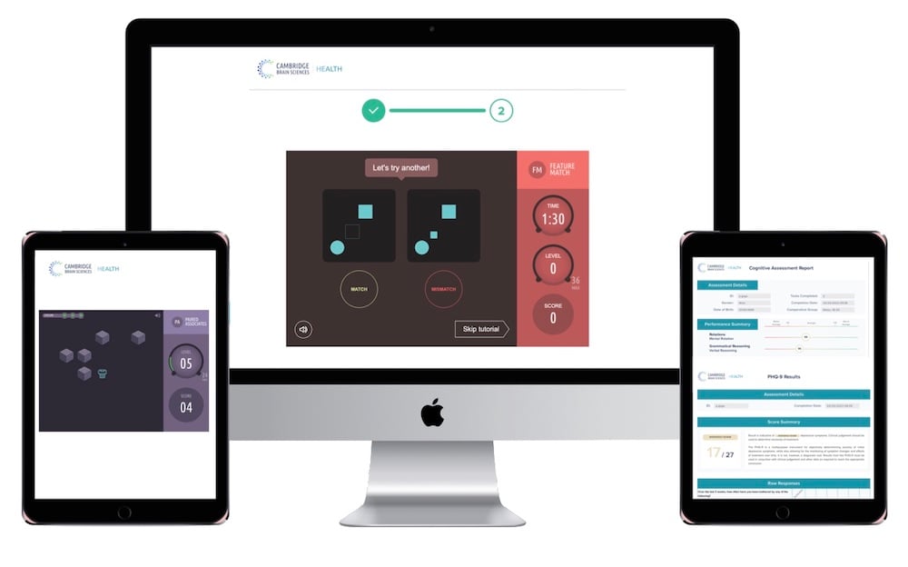 3 Examples of Computerized Cognitive Testing